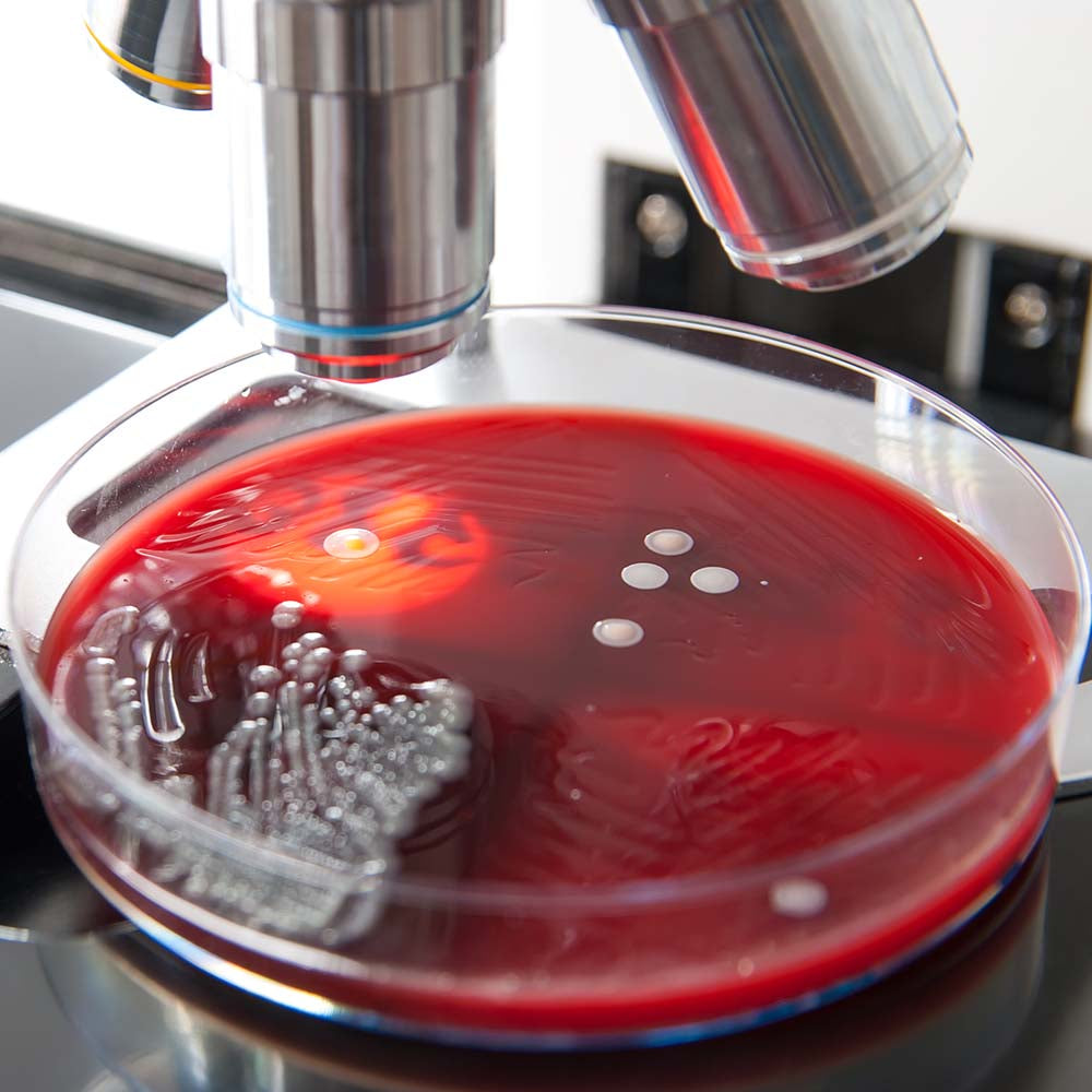 Aerobic Plate Count (APC) Test – Oahu Lab Testing and Compliance LLC